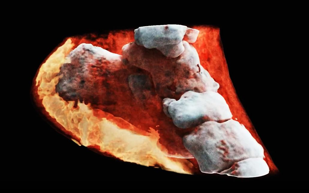 Bloody, Colorful X-Rays Reveal the Strange Beauty Of Human Body Parts ...