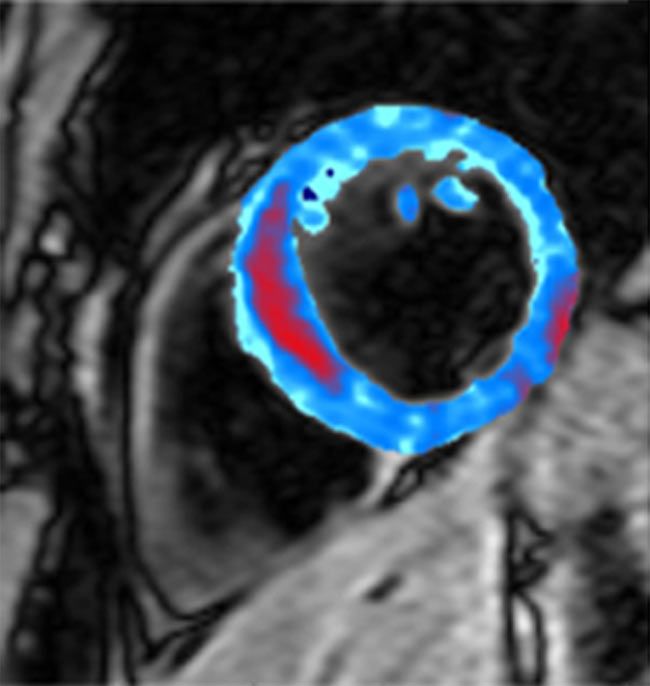 First Image of a Bleeding Heart | Live Science