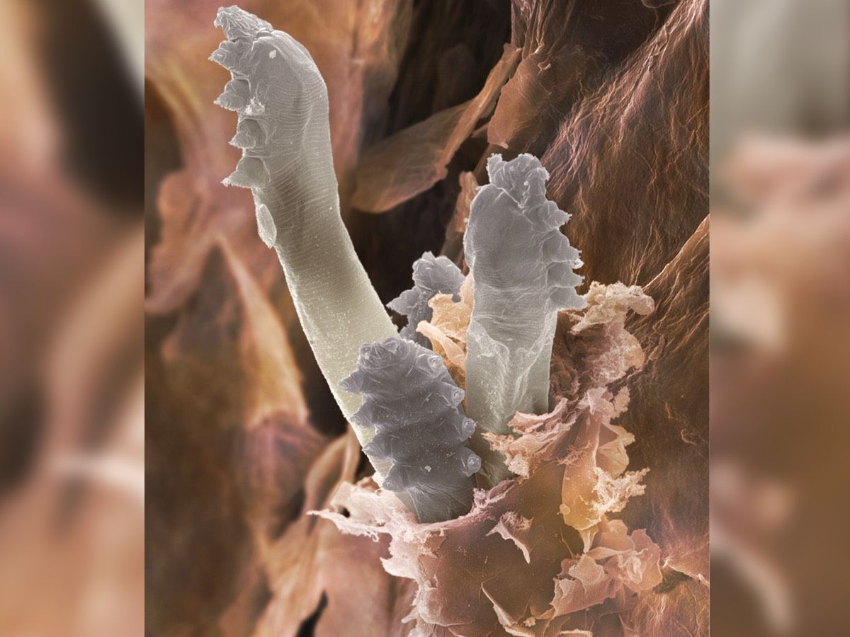 'Face Mites' Live in Your Pores, Eat Your Grease and Mate on Your Face ...