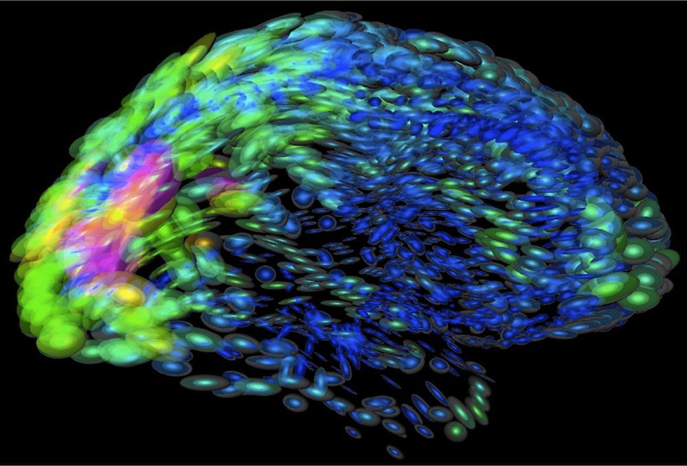 Bionic Humans: Top 10 Technologies | Live Science