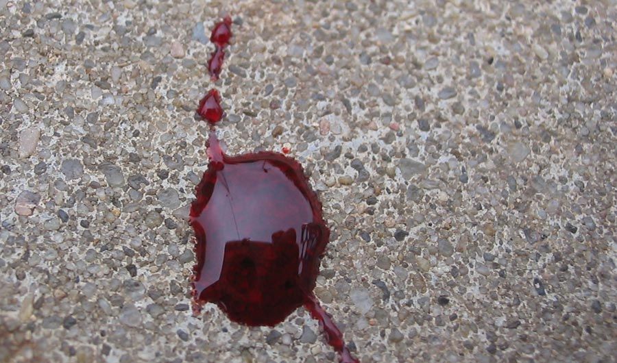 How Fake Blood Is Made to Look So Real | Live Science