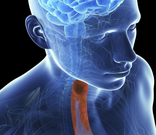 Throat-Closing Ailment EoE is a Mystery That Must Be Solved | Live Science