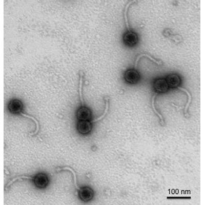 Zit-Zapping Virus May Wipe Out Acne | Live Science