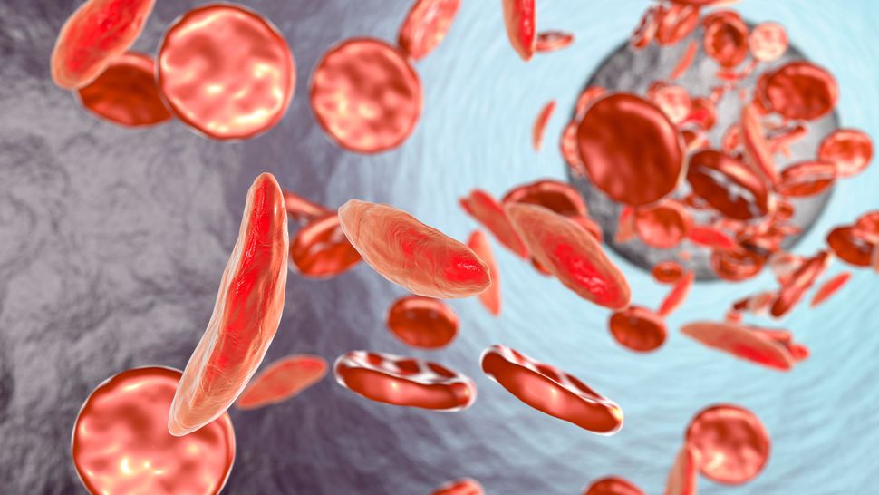 The world's 1st CRISPR therapy has been approved. Here's everything you ...