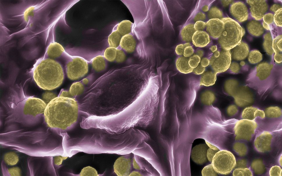 This Fungus Mines For Gold, Then Wears It | Live Science