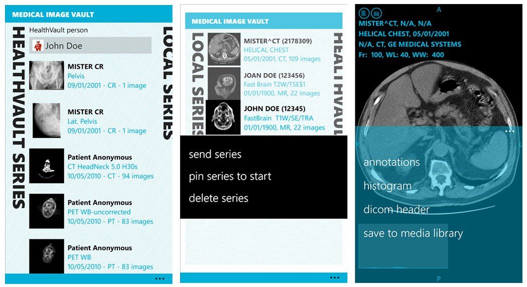 Medical Image Vault, a companion app for Microsoft’s HealthVault ...