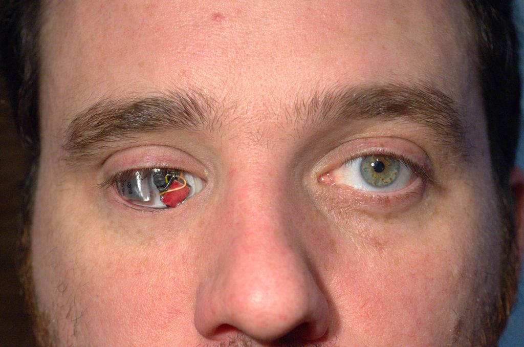 Eyeborg Project (Photos) | Live Science