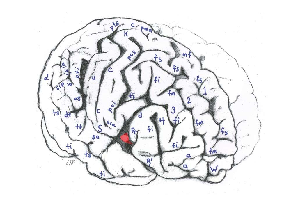Image Gallery: Einstein's Brain | Live Science