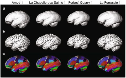 Scientists used computer imaging to potentially discover why ...