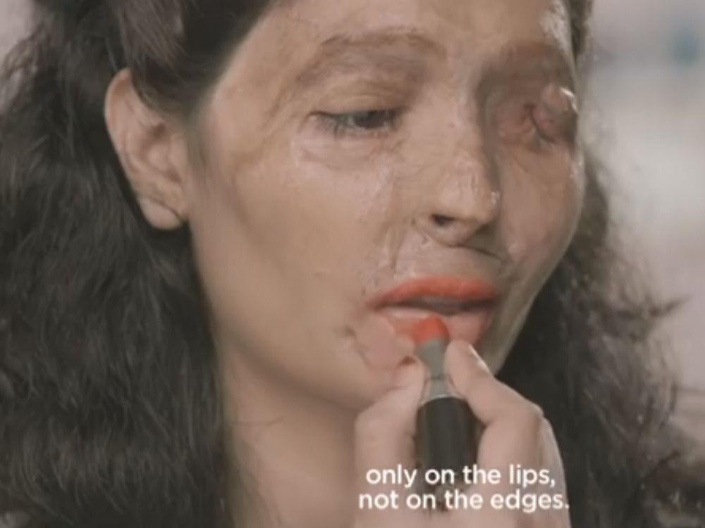 Make Love Not Scars: Acid Attack Survivor's Beauty Video | Marie Claire UK