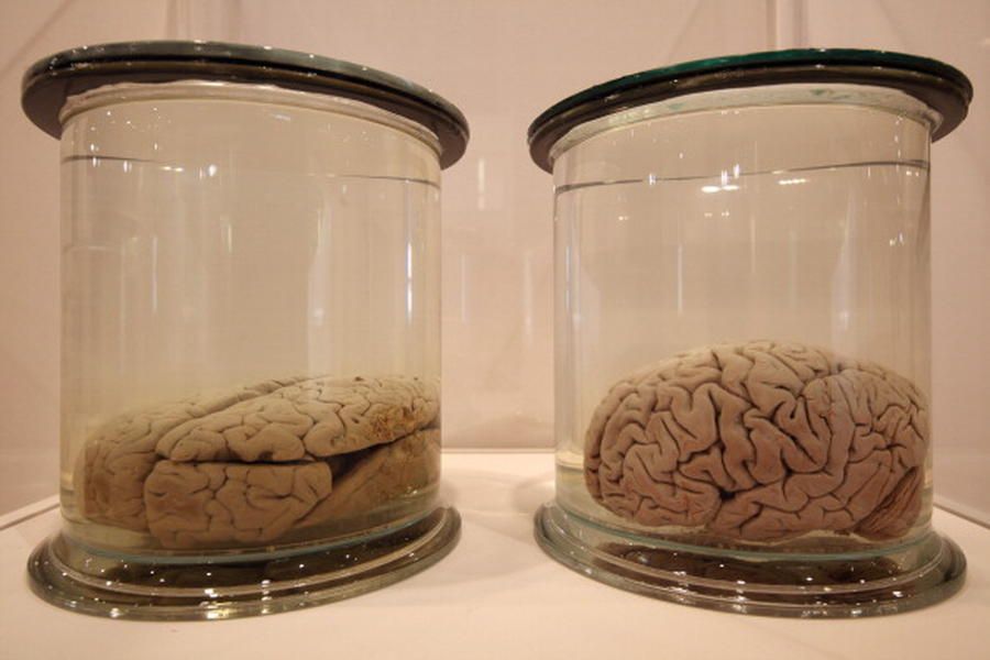 100 missing brains found in Texas | The Week