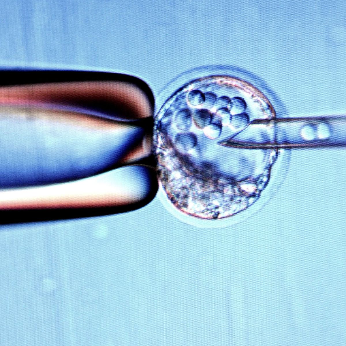 Man arrested with live human embryo in his suitcase | The Week