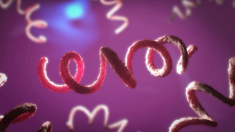 Syphilis cases are rising in the US | The Week