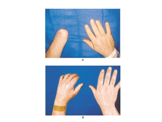 The Weirdest Fireworks Injuries Ever | Live Science