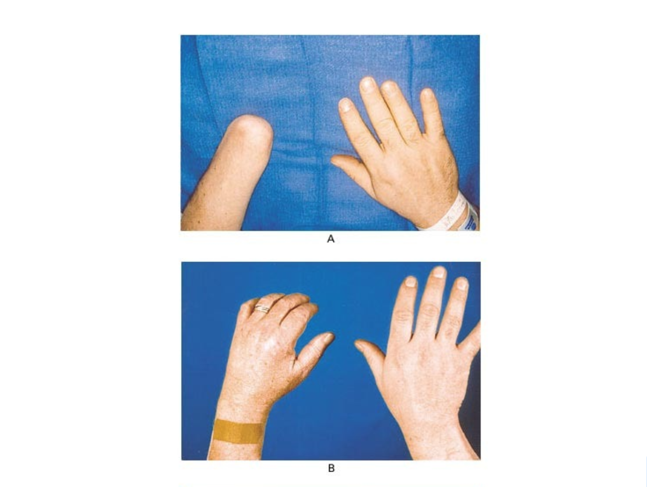 The Weirdest Fireworks Injuries Ever | Live Science