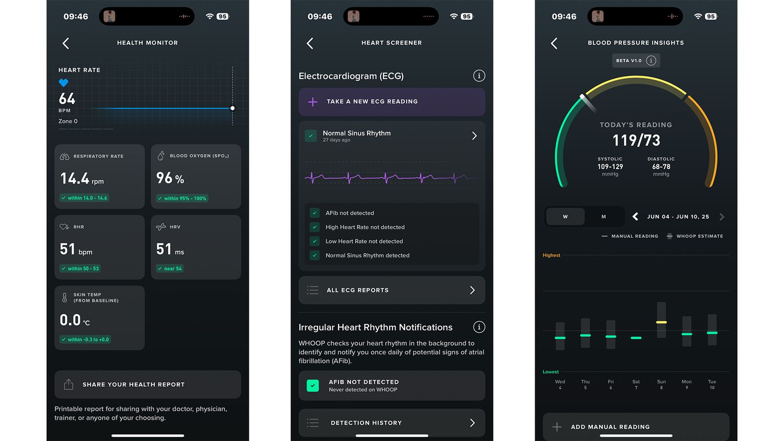 WHOOP just gave every member access to lab-based health insights for free | T3