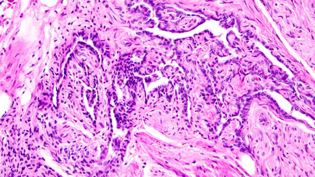 Pancreas: Function, Location & Diseases | Live Science