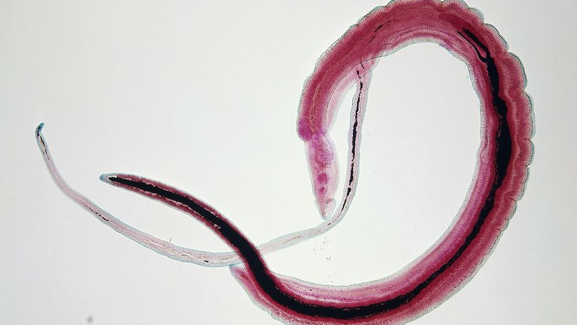 Can a Drug That Fights Parasites Also Help with Autism? | Live Science