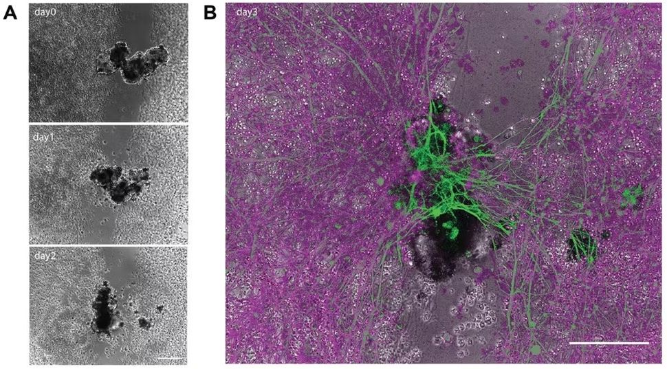 Some cells can enter a 'third state that lies beyond the traditional ...