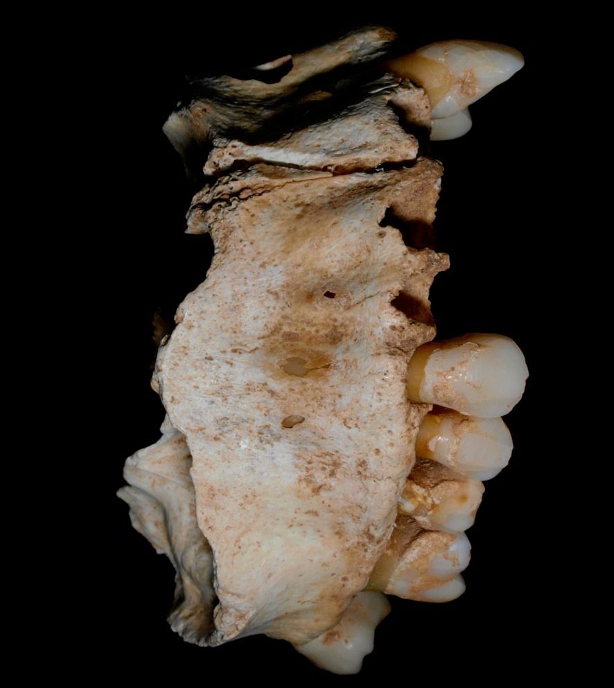 Philip Who? A Gallery of Mystery Bones | Live Science