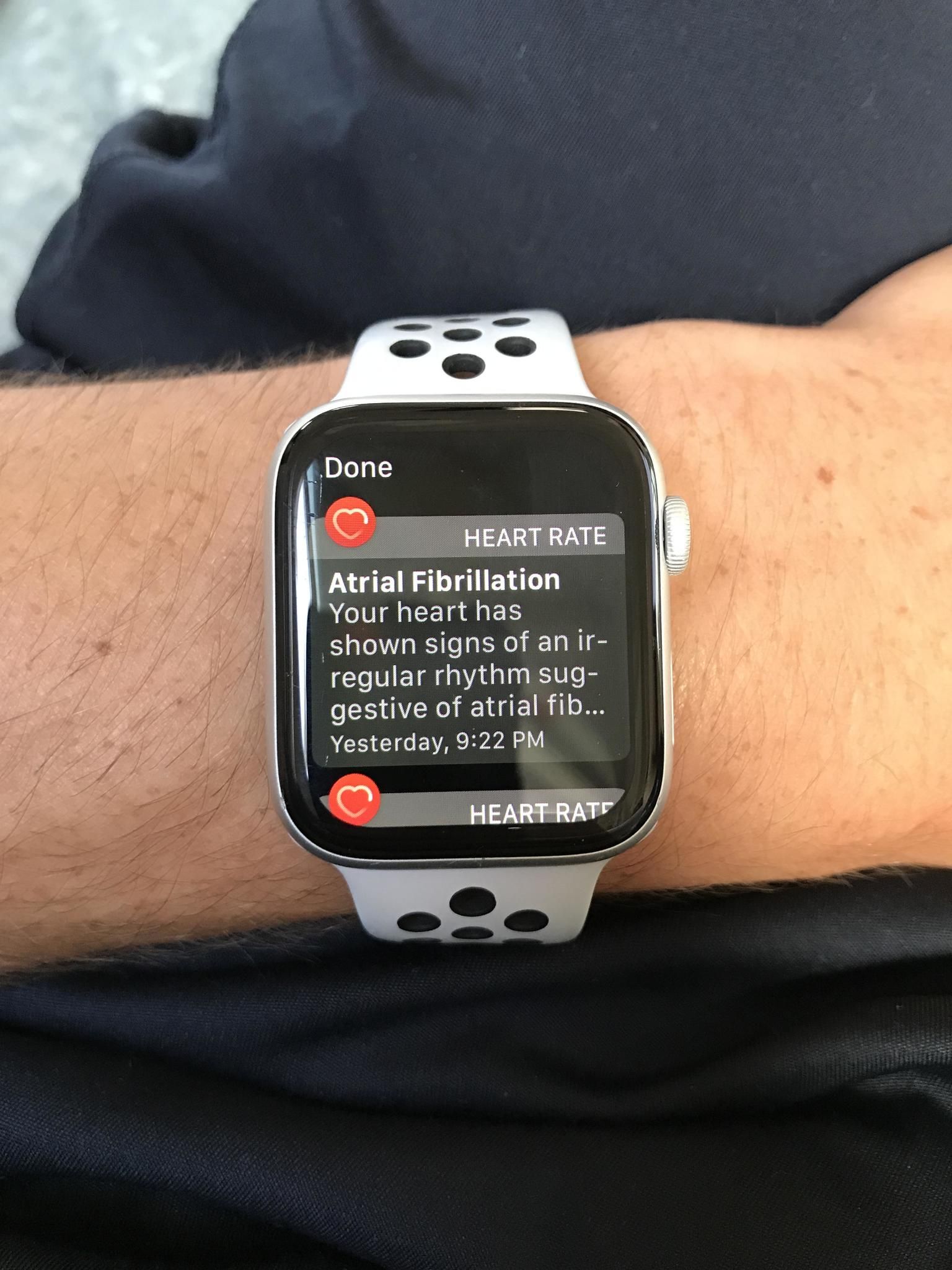 Apple Watch again successfully identifies AFib, alerts unsuspecting ...