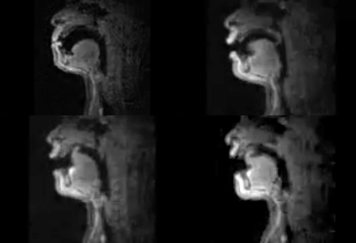 Watching People Beatbox in an MRI Machine Will Blow Your Mind | Live ...