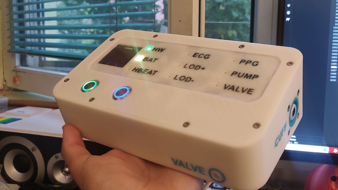 Raspberry Pi Pico W drives custom cardiography signal-measuring device ...