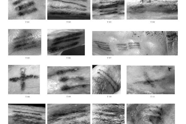 Ötzi the Iceman Liked His Acupuncture and Medicinal Herbs | Live Science