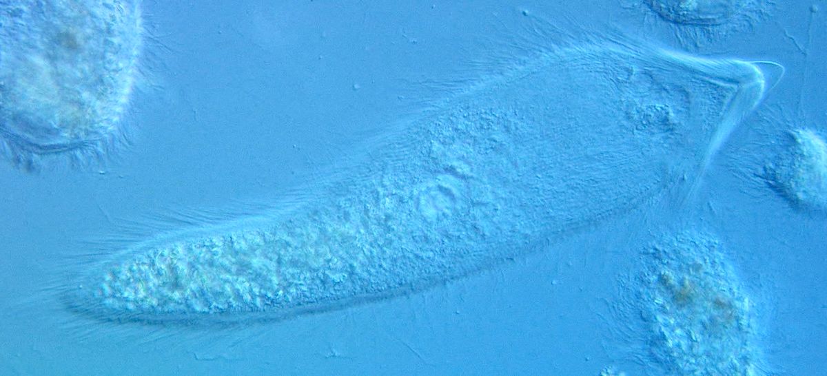 'Hairy' Microbes Named for Rush Members Are Living in the Limelight ...