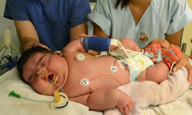 The science behind delivering a 13.5-pound baby | The Week