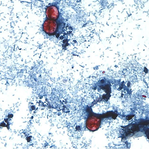 Dozens Fall Ill in Texas Outbreak: What Is Cyclospora? | Live Science
