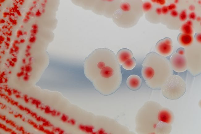 Pink mould in shower? Why it might be more disgusting than you think ...