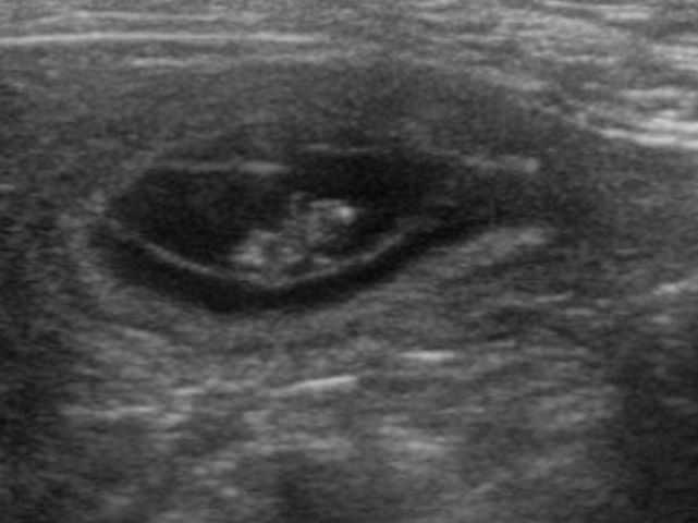 Photos: Fertility Eggs-periments Yield Litter of Playful Pups | Live ...