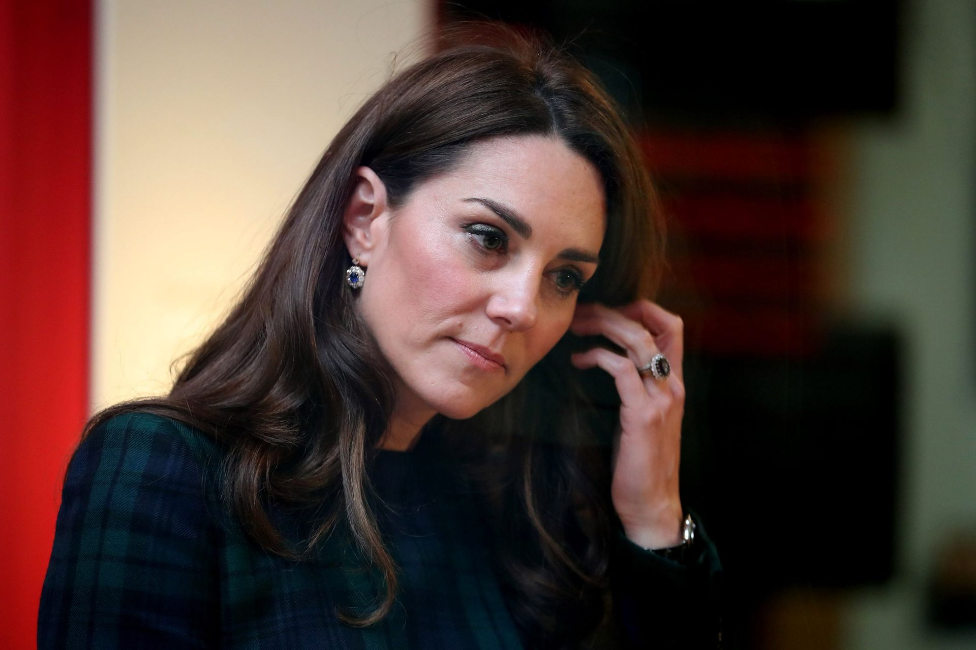 This Is The Reason Behind The Scar On Kate Middleton's Face | Marie ...