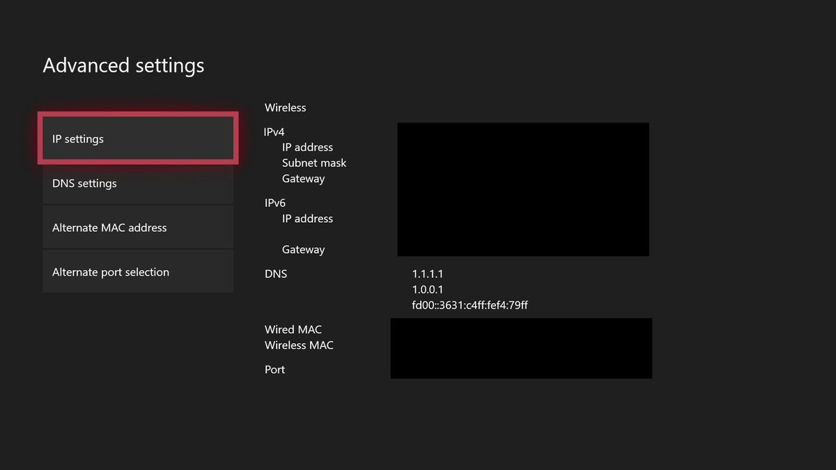 How to change Xbox One DNS to boost network speed and privacy | Windows ...