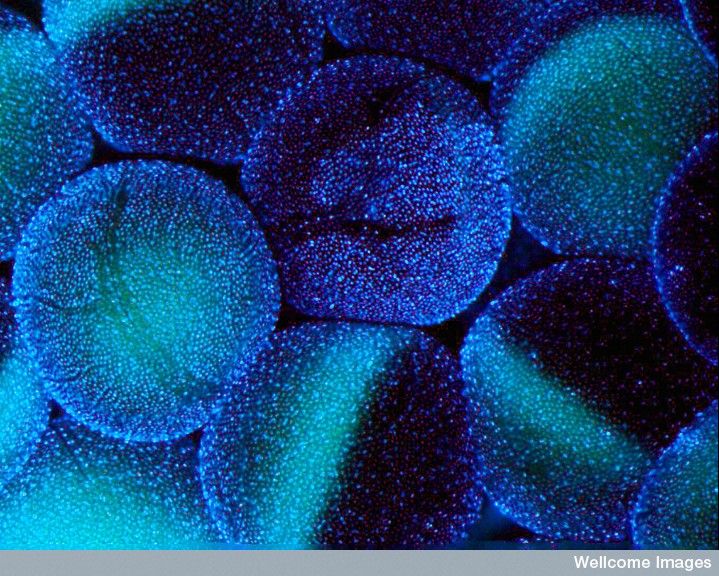 Beauty and Brains: Award-Winning Medical Images | Live Science