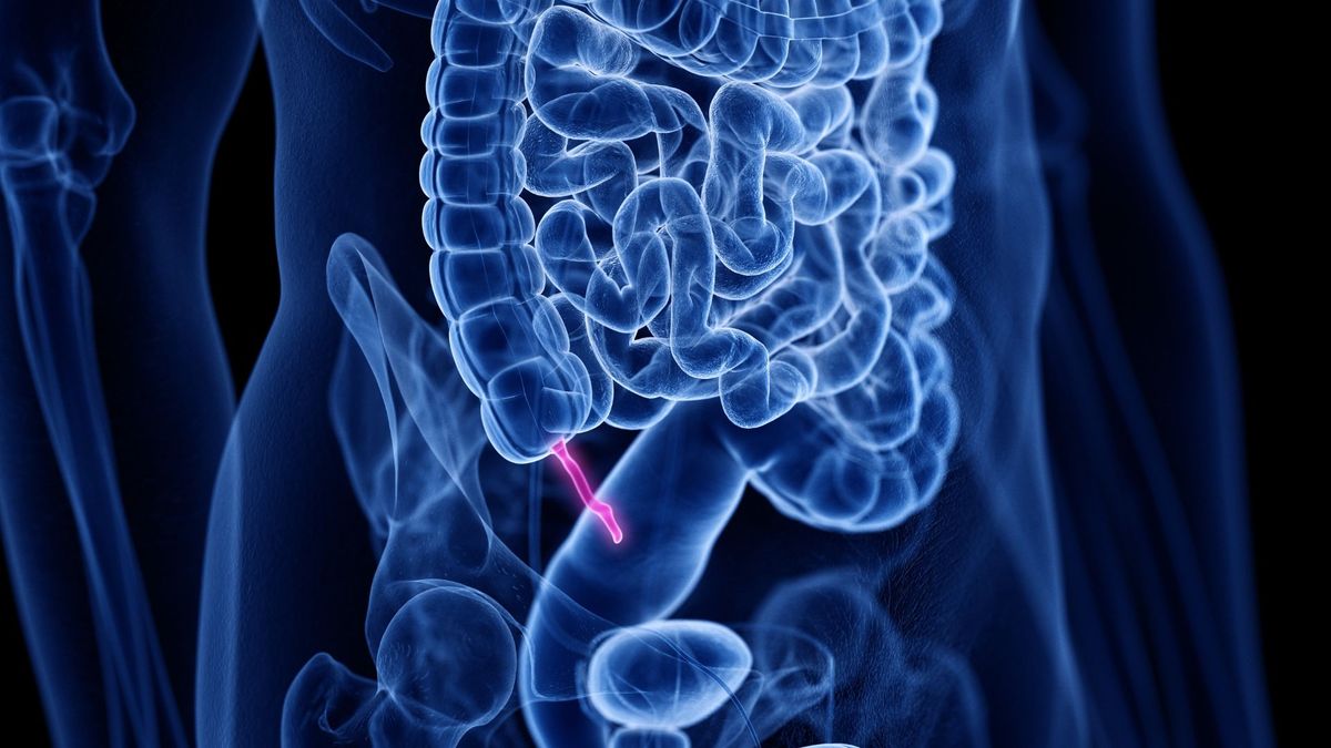 Appendicitis