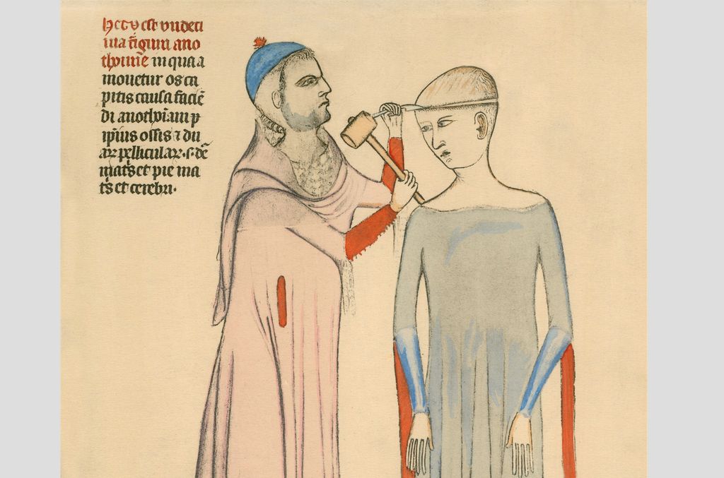 These 'Barbaric' Medical Treatments Are Still Used Today | Live Science
