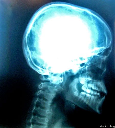 Woman Survives 'Internal Decapitation' | Live Science