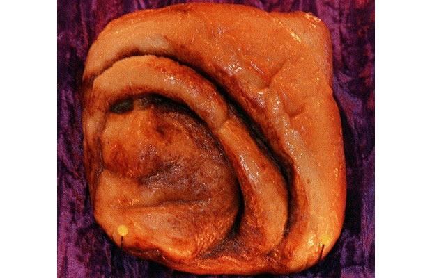 What is pareidolia? | Live Science