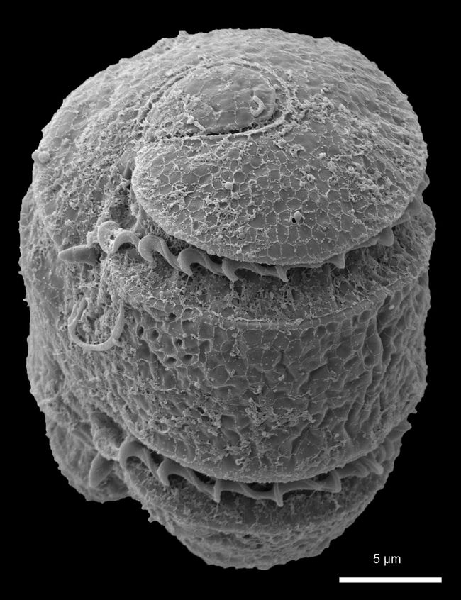 In Photos: Tiny Plankton Show Off Advanced Weaponry | Live Science