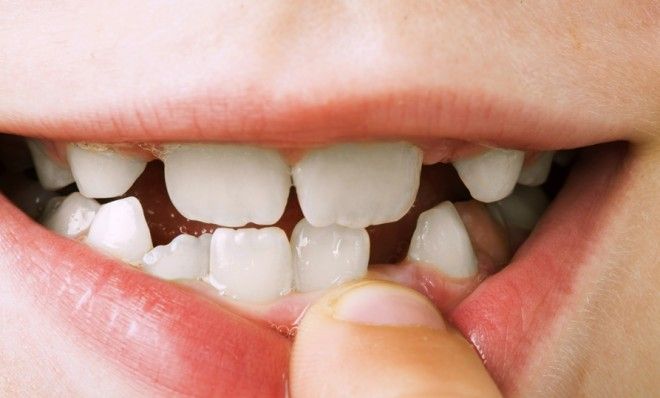 Is there a Tooth Fairy bubble? | The Week