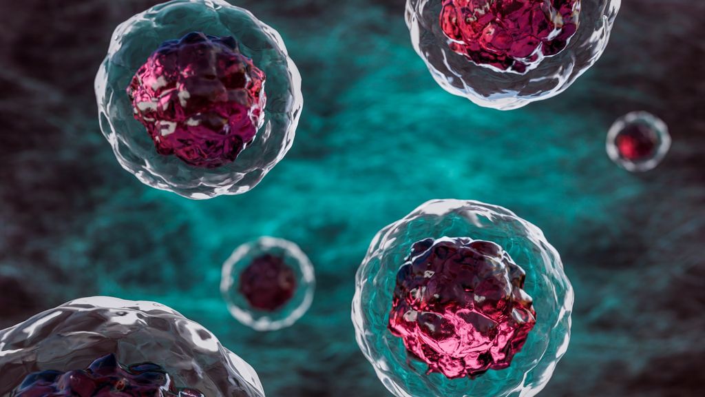 Slaying 'zombie cells' in blood vessels could be key to treating ...