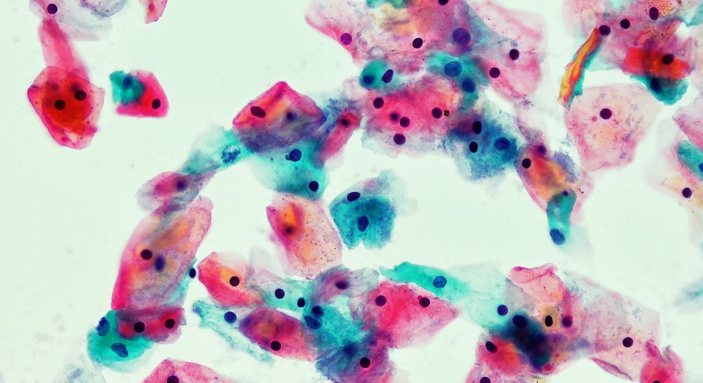 What is a pap smear? Plus, what to expect at your screening | Woman & Home