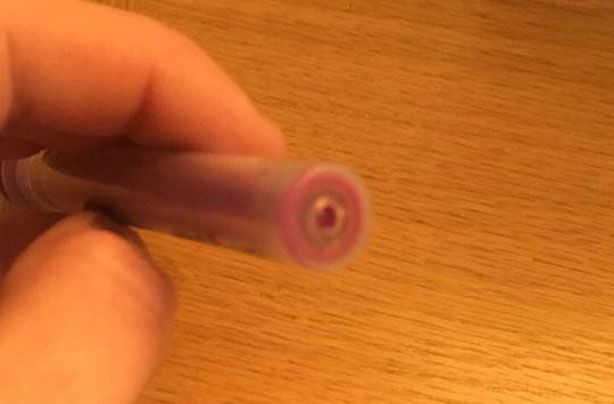'Such a good idea!' Mum's 'pain free' splinter removal hack goes viral ...