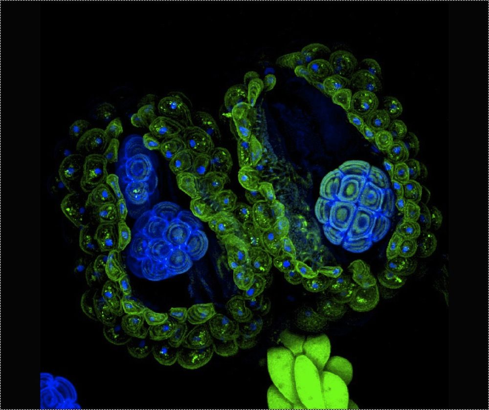 Small World: Gallery of Microscopic Beauty | Live Science