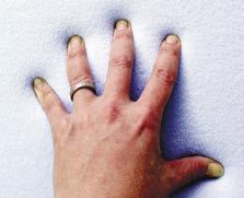 Everyday Tech From Space: 'Memory Foam' for the Masses | Space