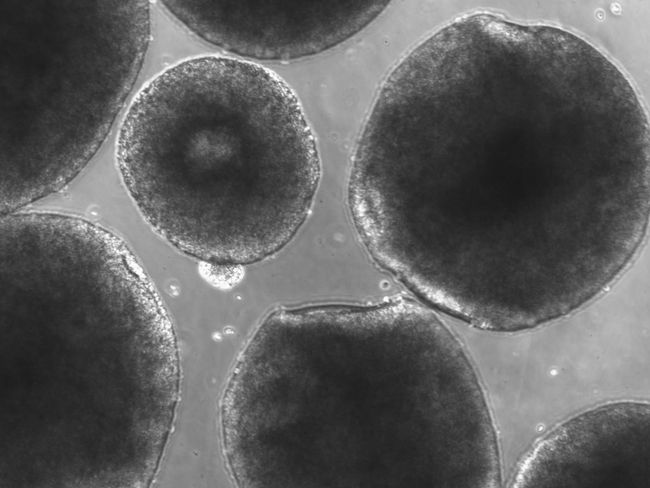 Mini Neanderthal Brains Are Growing in Petri Dishes | Live Science