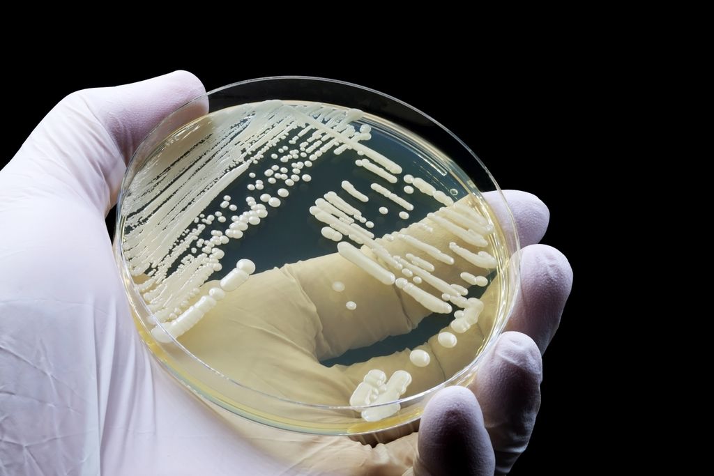 How the rise of C. auris was inevitable | Live Science