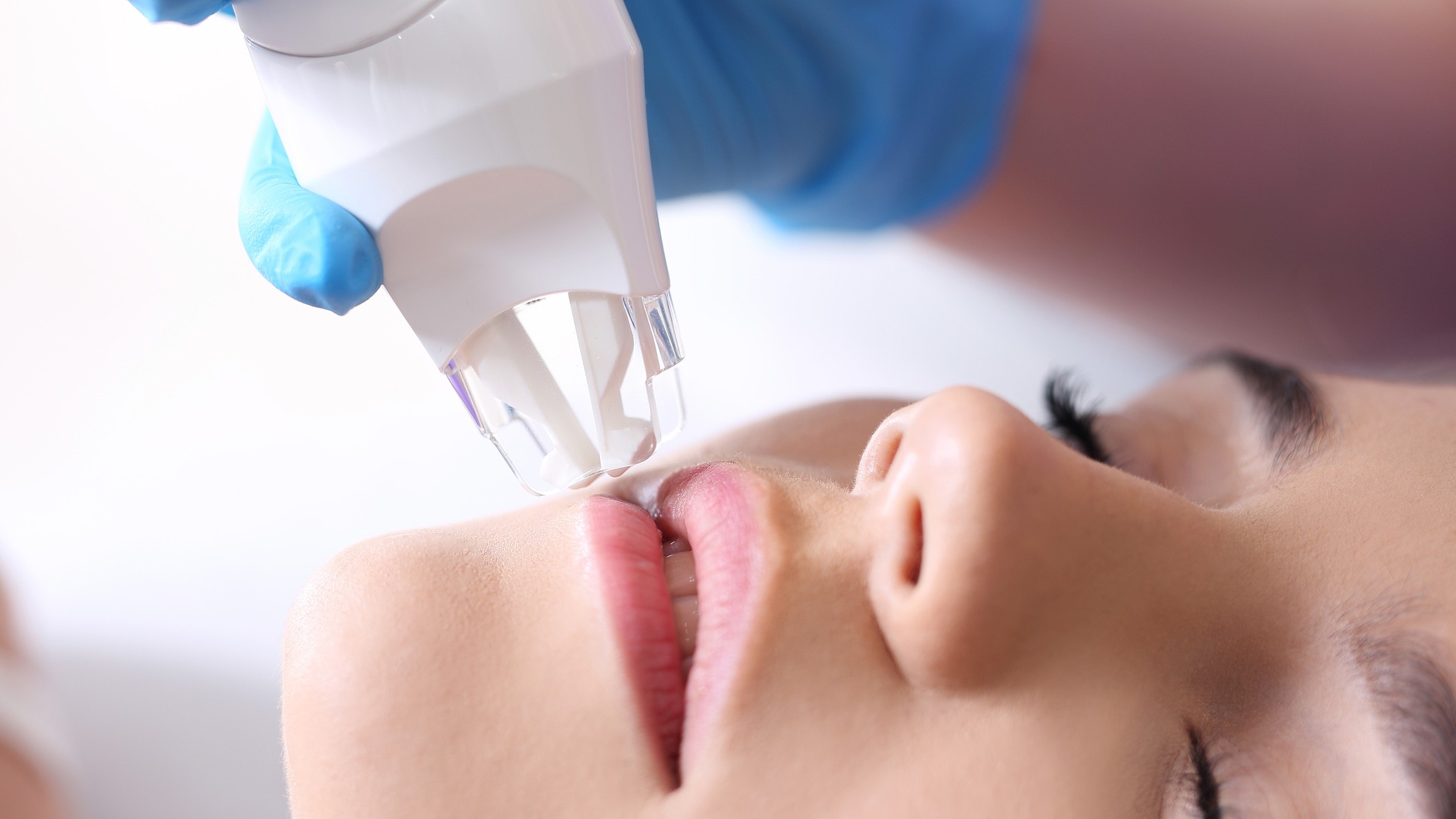 How to remove facial hair permanently, according to experts | My ...